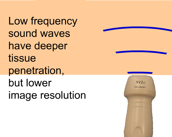 Echocardiography Tutorial - What is Echocardiography?